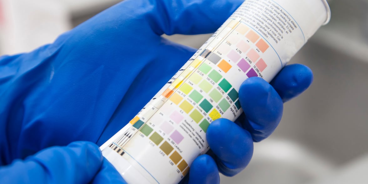 The Limits of Color-Change pH Tests